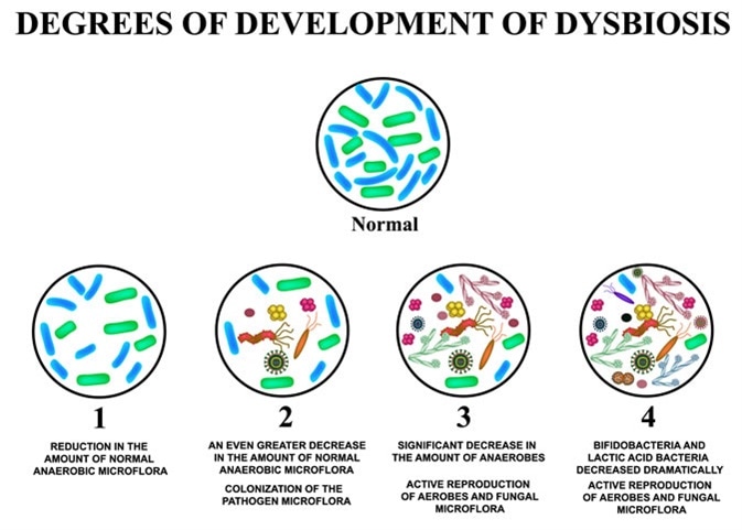 Dysbiosis and Ageing - Thailand Medical News