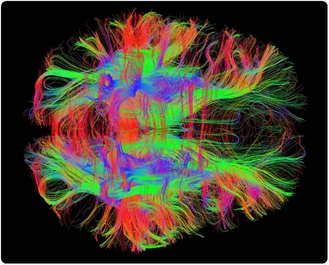 Diffusion Tensor Imaging (DTI) Explained - Thailand Medical News